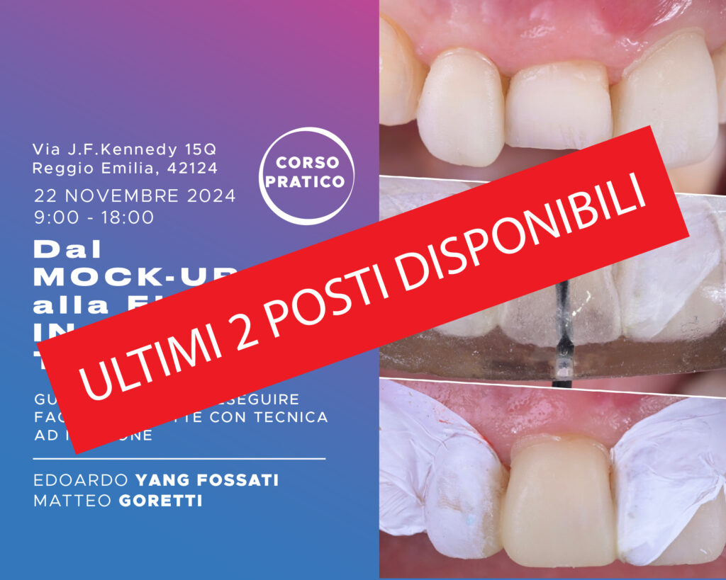 Dal mock-up alla flow injection technique I Occhiali ingrandenti Q-Optics